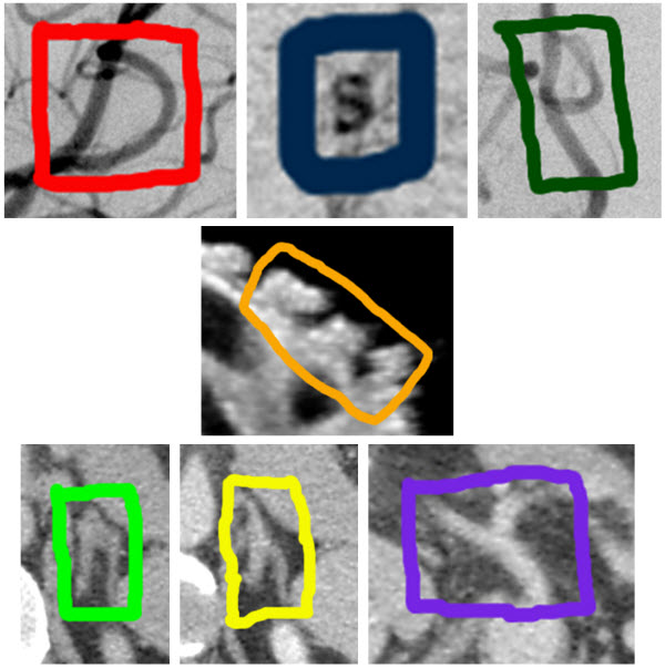 Radiology Alphabet Soup | luk | Journal of Radiology Case Reports